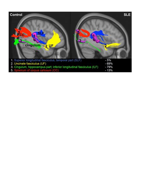 Quinolinic Acid A Kynureninetryptophan Pathway Metabolite Correlates