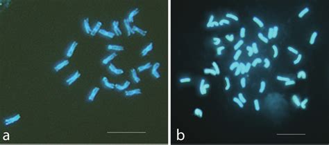 Mitotic Metaphases Of F Vulgare Chromosome Complements Of Diploid A Download Scientific