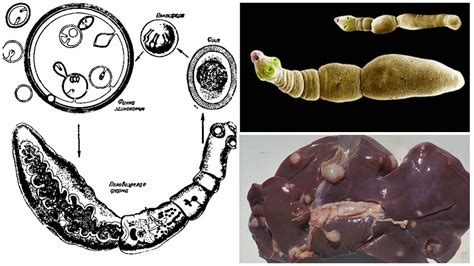 Альвеококк Паразиты в организме человека