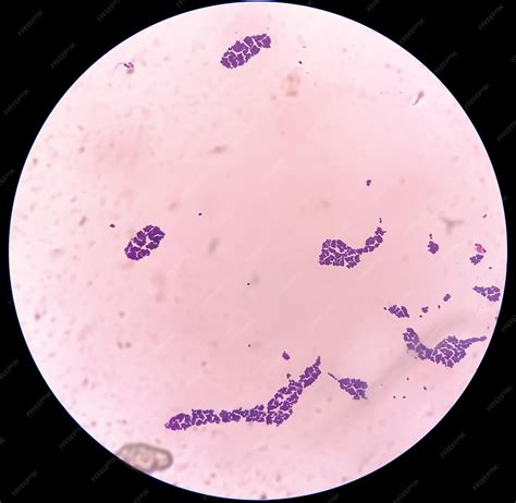Premium Photo Candida Colony Under Microscopic View Or Candida
