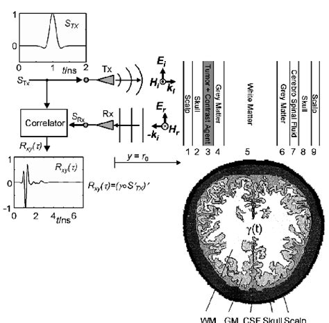 Uwb Radar Probing A Multilayered Dielectric Structure The Human Head