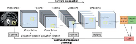 Deep Learning Image Reconstruction For Ct Technical Principles And Clinical Prospects Radiology