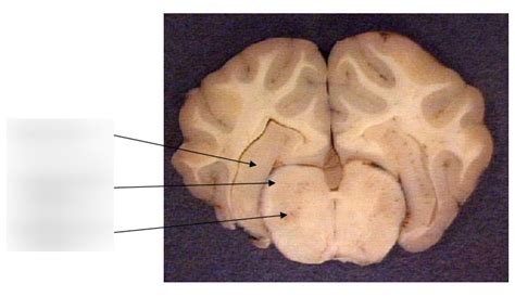 Brain Dissection 9 Diagram Quizlet