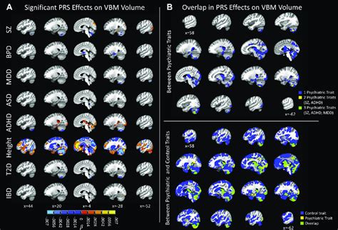 Polygenic Risk Score Prs Effects On Voxel Based Morphometry Vbm Download Scientific Diagram