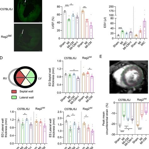 Single Cell Rna Sequencing Analyses Reveals Strain Dependent