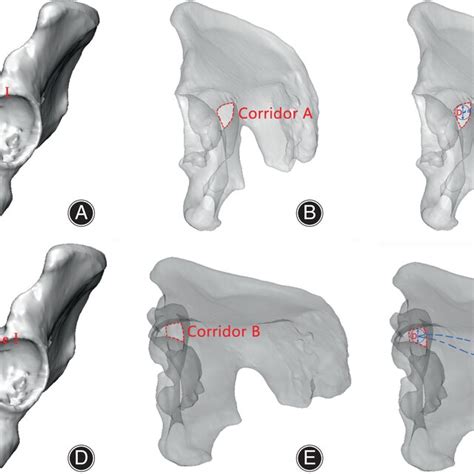 The Pubic Was Divided Into Zone I Zone II And Zone III According To Download Scientific