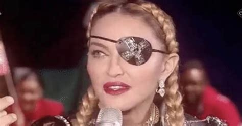 Eurovision Viewers Concerned Over Madonnas Eyepatch Omg Is She Okay