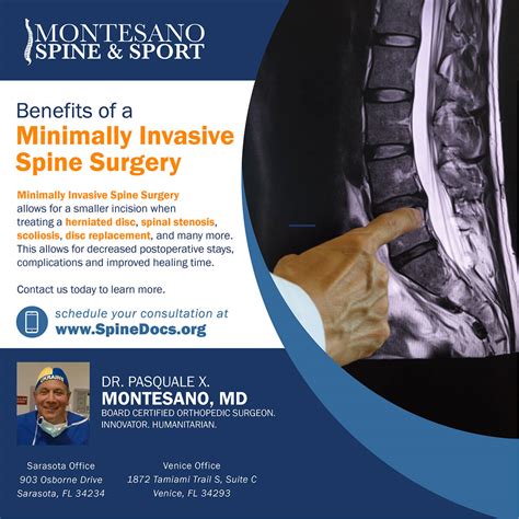 Benefits Of Minimally Invasive Spine Surgery Spine Docs