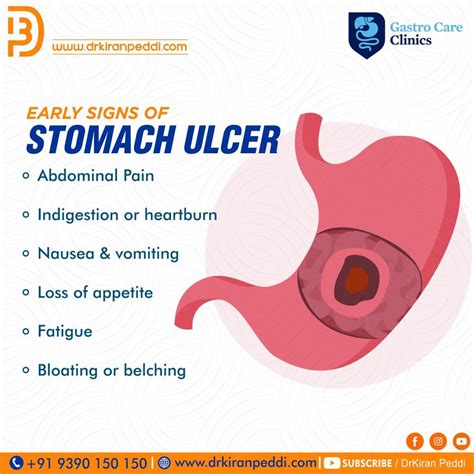 Stomach Ulcer Dr Kiran Peddi By Drkiranpeddiinfo On Deviantart