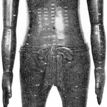 Pdf A Brief History Of Acupuncture
