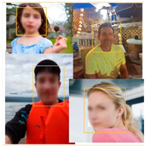 Symmetry Free Full Text Symmetry Based Fusion Algorithm For Bone Age Detection With Yolov5