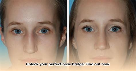 High Nose Bridge Guide Shape Fit And Reshaping Options Lifestyle And