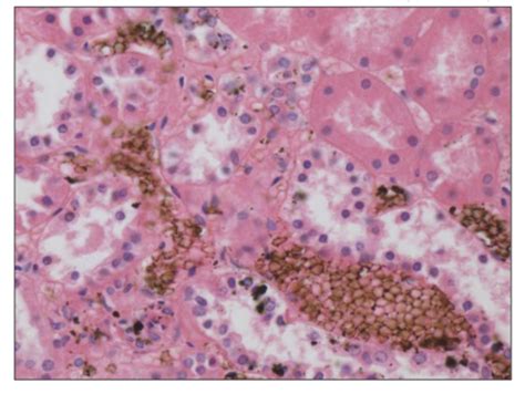 General Staining Methods And Troubleshooting 1011 Flashcards Quizlet