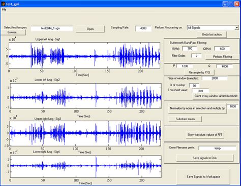 2 The Developed Gui For Pre Processing Operations Download