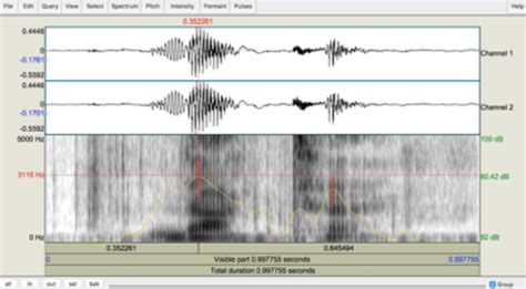 An Example Showing A Waveform Display Upper Panel And A Spectrogram