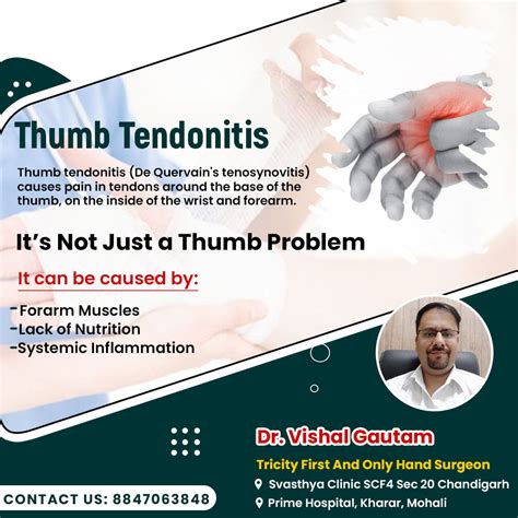 Thumb Tendonitis Is A Orthopaedic Hand And Wrist Clinic