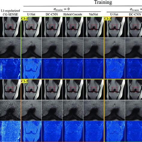 the results of reconstructed images in experiment 3 the error images