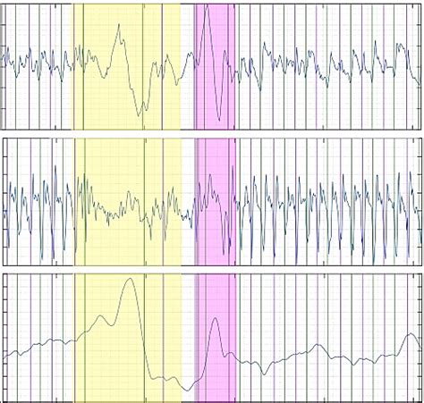 Projects Computer Vision Lab