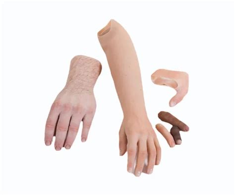 Silicone Hand Prosthesis Passive Prosthetic Below The Elbow At ₹ 100000piece In Jalandhar