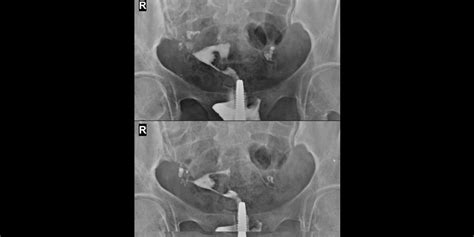 Services Contrast Procedures