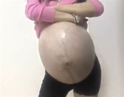 Skinny Girl With Massive Pregnant Belly
