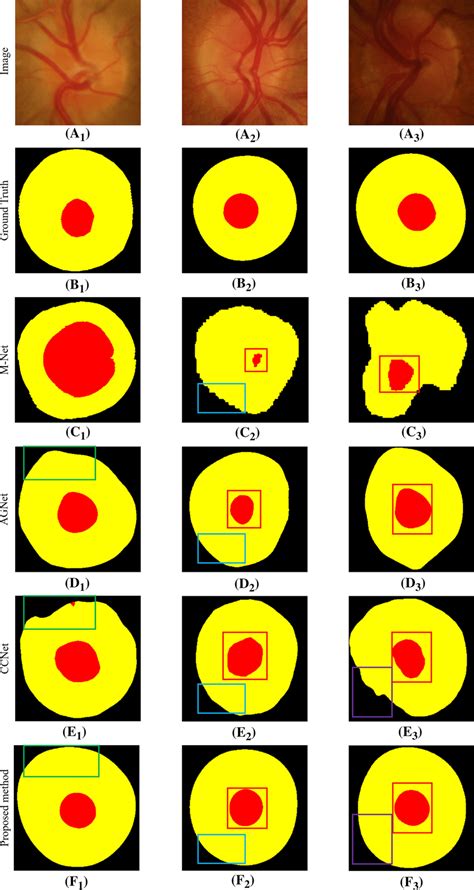 Examples Of Visual Segmentation Results Where The Yellow Region Download Scientific Diagram
