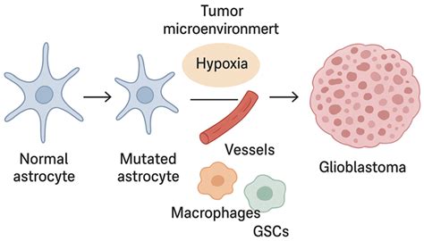 Glioblastoma—a Contemporary Overview Of Epidemiology Classification