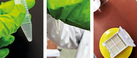 Preparation Of The Fixed Organoids For The Paraffin Embedding Download Scientific Diagram