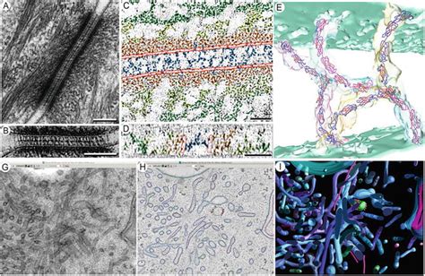 Electron Tomography For Organelles Cells And Tissues Radiology Key
