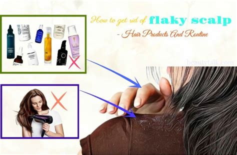 Top 5 Ways On How To Get Rid Of Flaky Scalp In Winter At Home