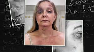 Virginia Giuffre Cause Of Death Epstein Survivor And Prince Andrew Accuser Dead At 41