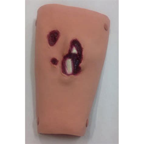 Simulaids Compound Fracture Tibia Lower Leg Light Skin Tone Bound Tree