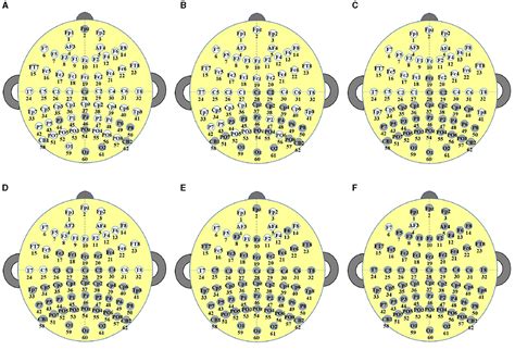 frontiers two stage sparse multi objective evolutionary algorithm for