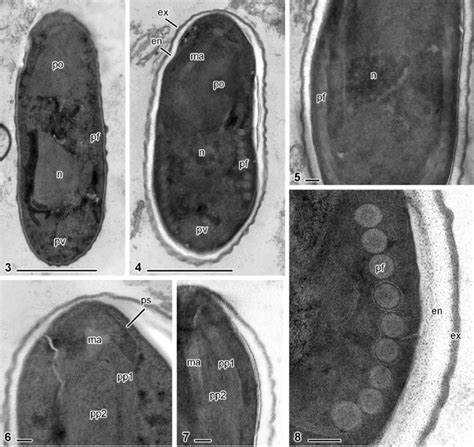 Transmission Electron Micrographs Of Microsporidian Spores Infecting C