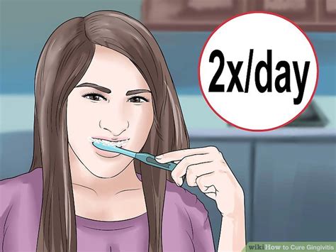3 Ways To Cure Gingivitis Wikihow Health