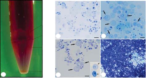 Brycon Orbignyanus Cell Purification In Percoll Gradient A Cell Bands