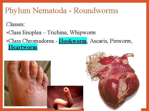 The Worms Phylum Platyhelminthes Phylum Nematoda Phylum Annelida