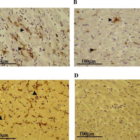 Demonstration Of Endothelial Cell Activation And Microvascular Damage