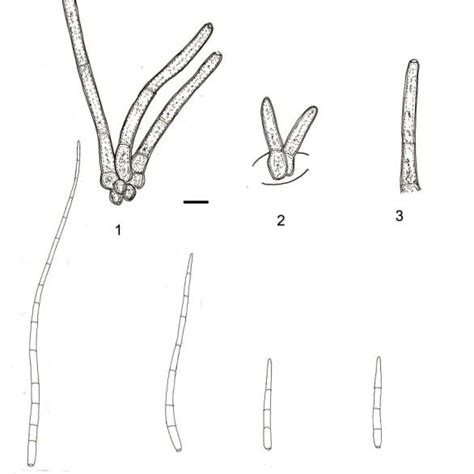 Cercospora Coffeicola On Coffea Arabica From Leaf Spots 1 Stroma Download Scientific Diagram