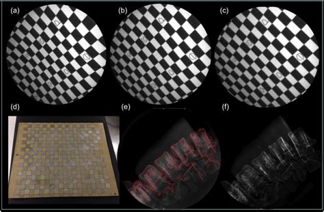 A Raw X Ray B X Ray After Radial And Tangential Rectification C