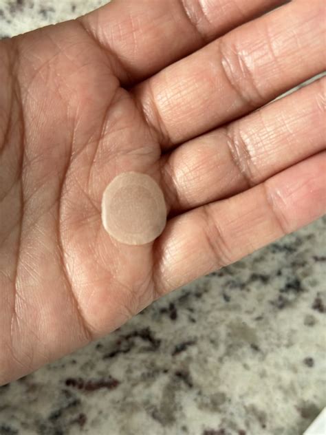 Fur Ingrown Microdart Patch Review With Photos Ps Beauty