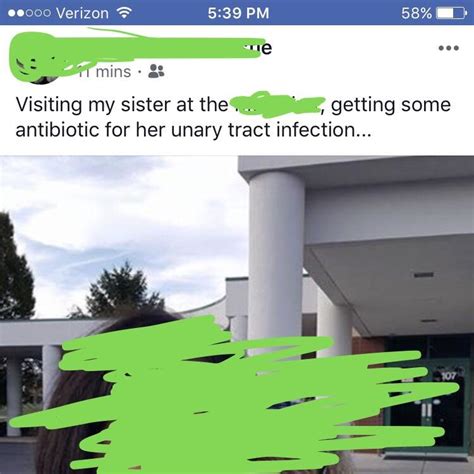 Unary R Excgarated