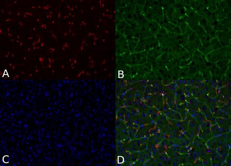 Histosure Collagen Type Iv