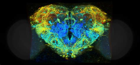 P{vt000107 Gal4} Expression Pattern [vfbexp Fbtp0102798] Virtual Fly Brain