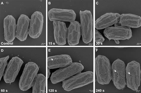 Microscopiodebacillussubtilis