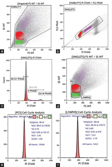 Study Of Dna Ploidy In Newly Diagnosed Multiple Myeloma By Flow