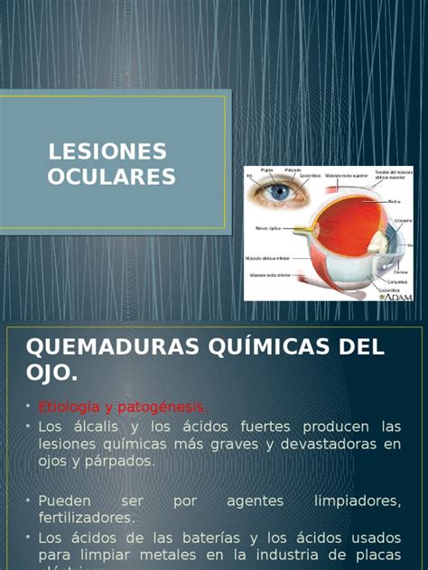 Lesiones Oculares Pdf Ojo Humano Herida