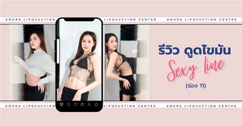 รววดดไขมน Sexy Line Amara Clinic