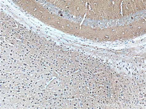 Alpha Synuclein Antibody 10842 1 Ap Proteintech 武汉三鹰生物技术有限公司