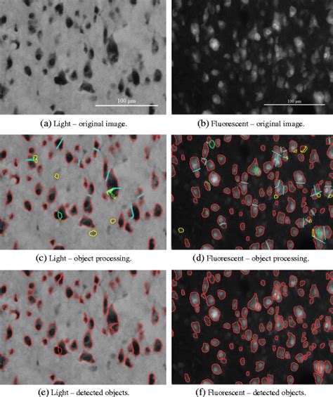 The Examples Of Cell Detection With Cas The Samples Of Tissue With